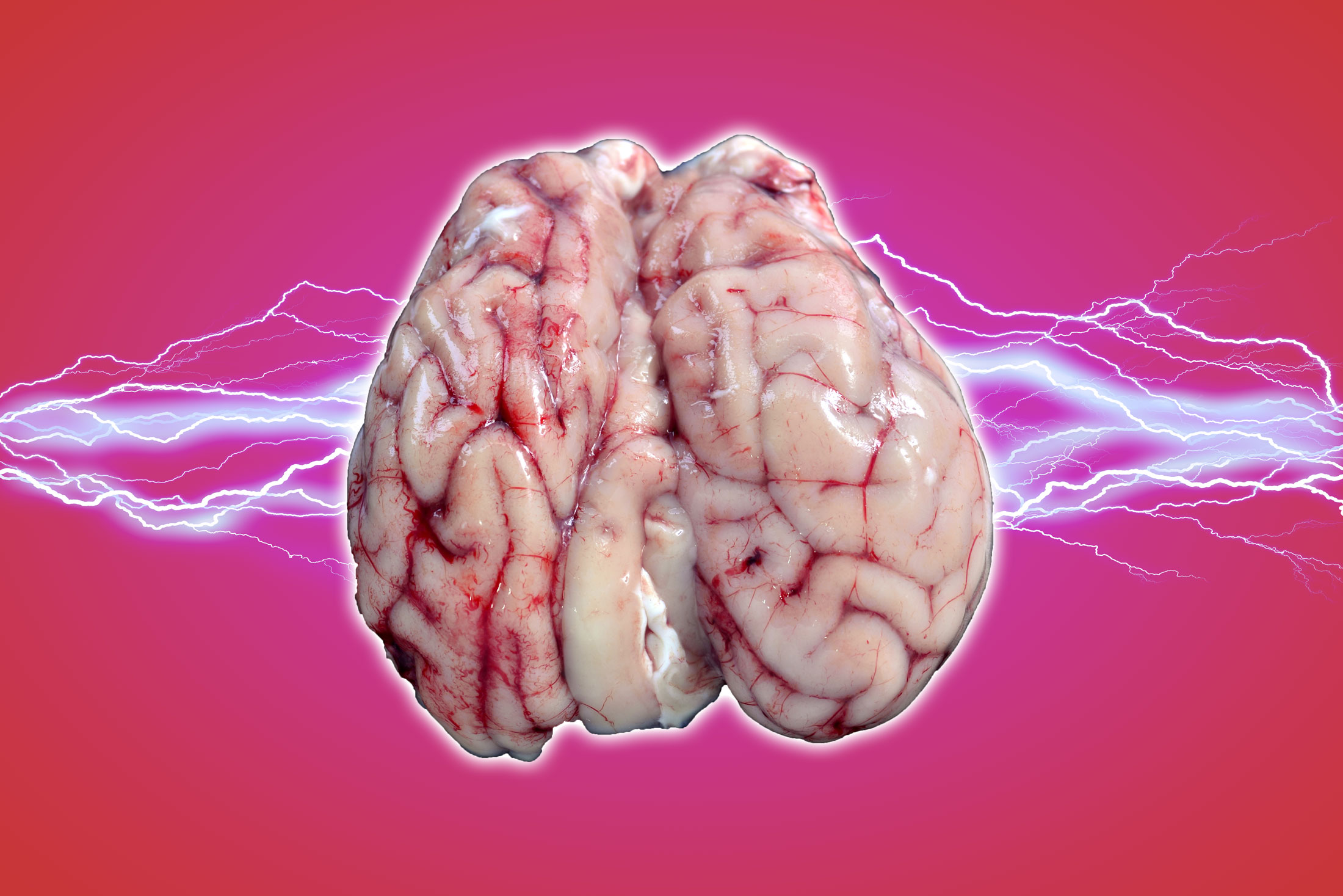 Researchers Have Restored Basic Brain Function in Dead Pigs