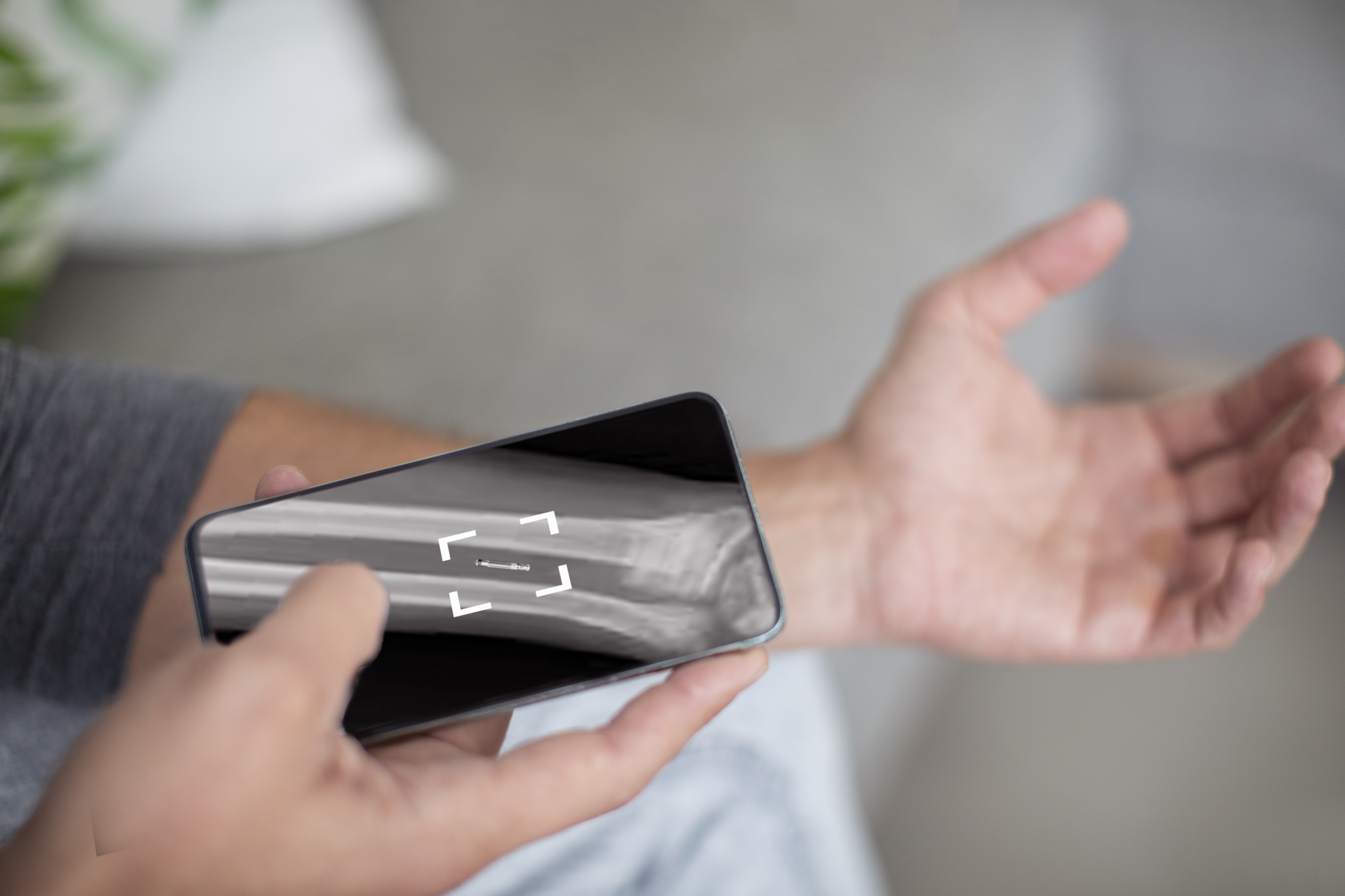 Inside an Online Community of People With Microchip Implants